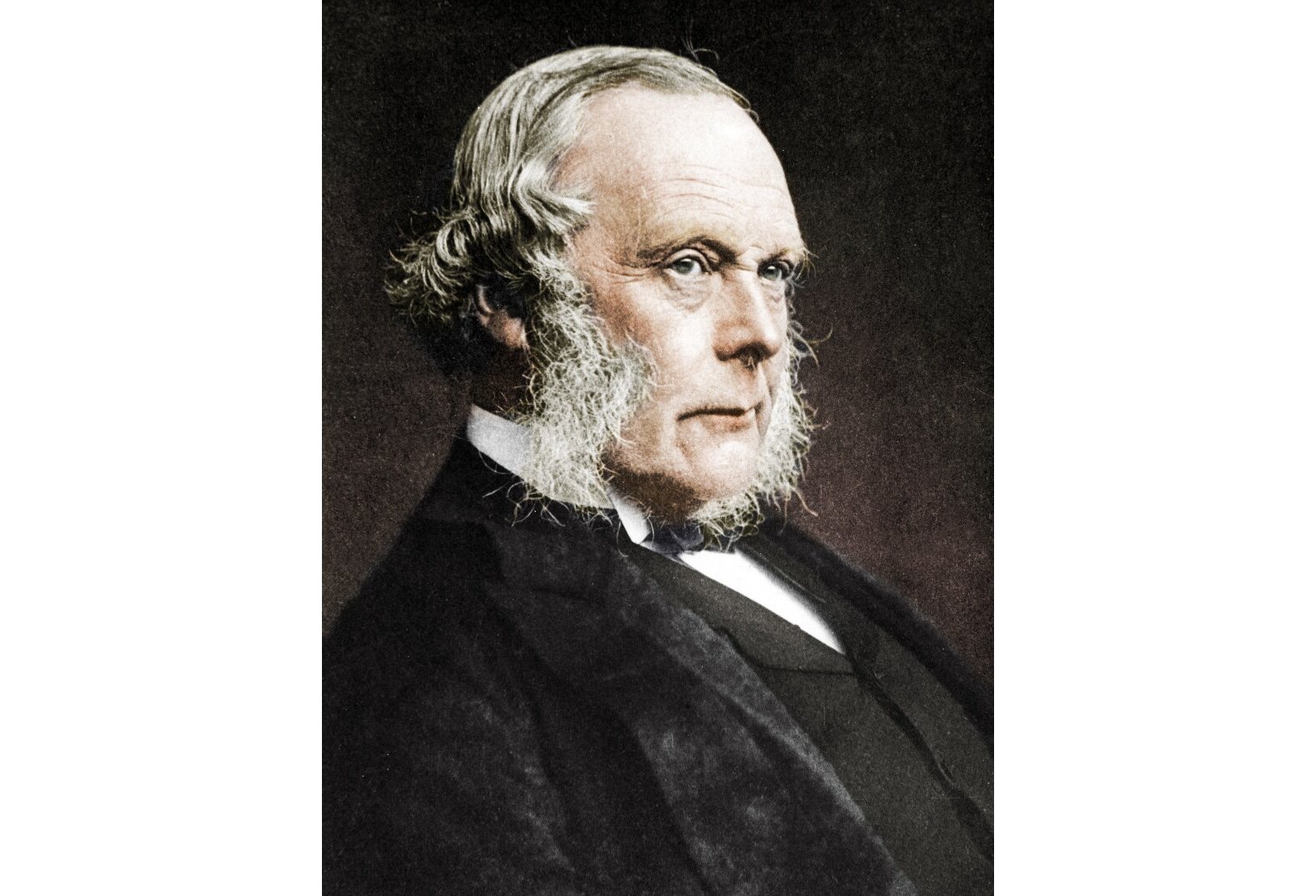 Joseph Lister - Visuotinė lietuvių enciklopedija