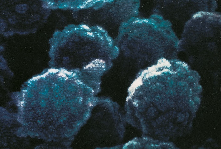 AIDS - Visuotinė lietuvių enciklopedija