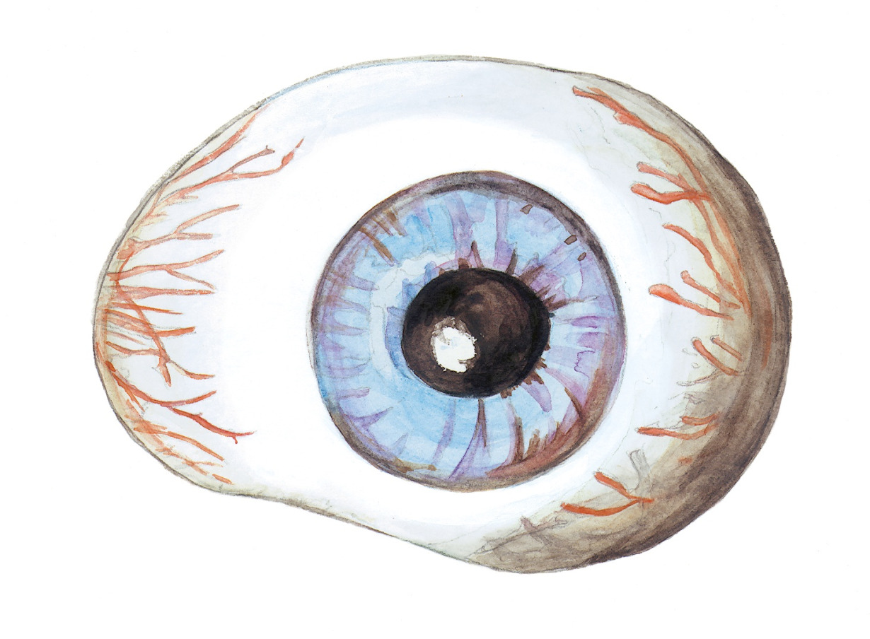 akies protezas - Visuotinė lietuvių enciklopedija