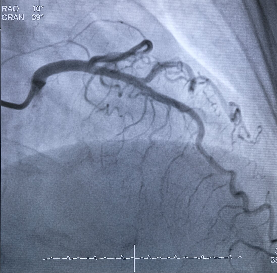 angiografija - Visuotinė lietuvių enciklopedija