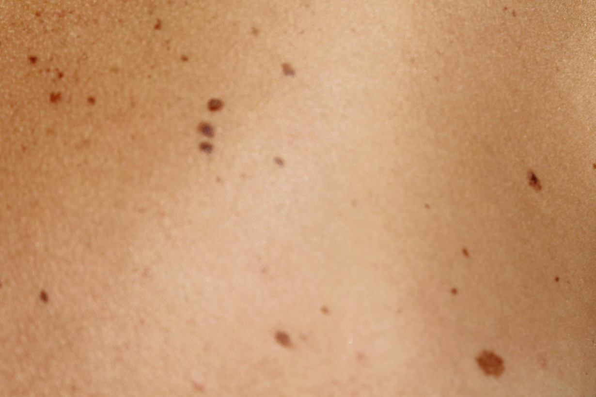 apgamas - Visuotinė lietuvių enciklopedija